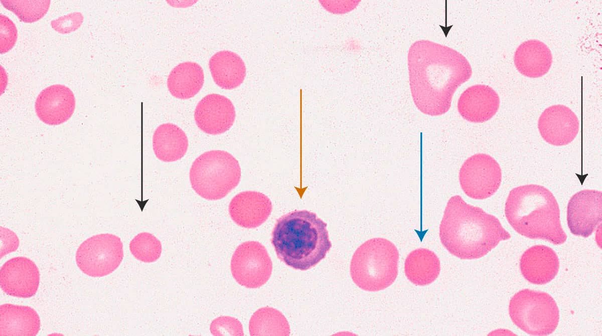 Alterações da série vermelha