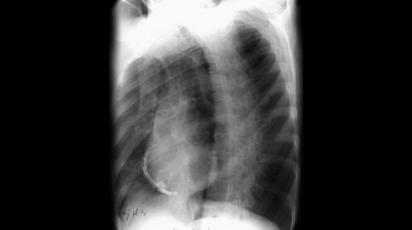 ANATOMIA RADIOLÓGICA DO TÓRAX