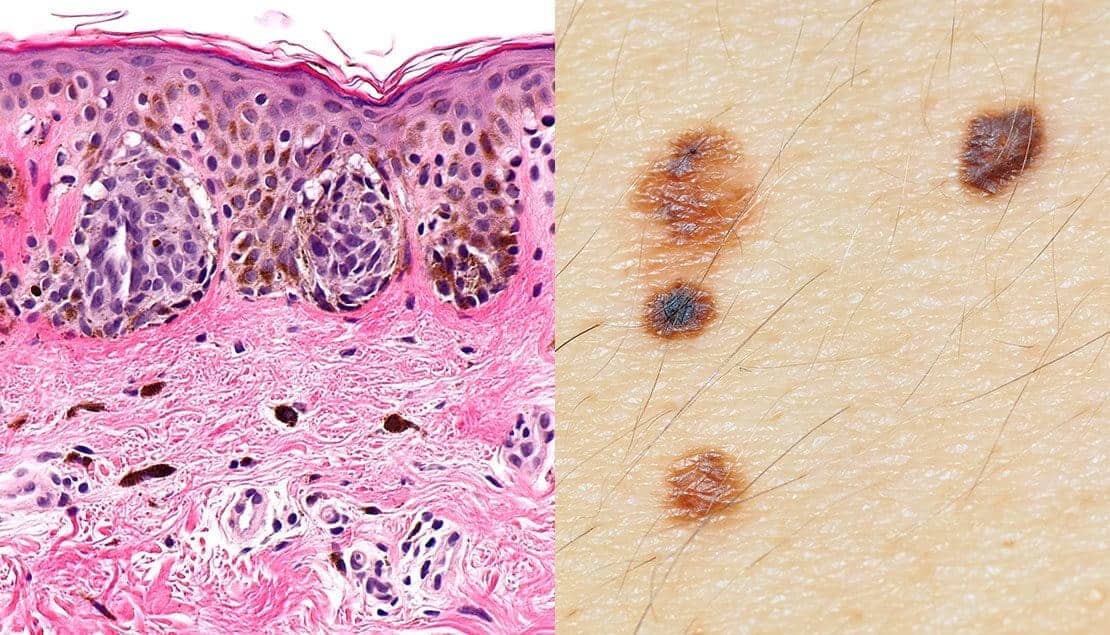 Distúrbios pigmentares e calcificações