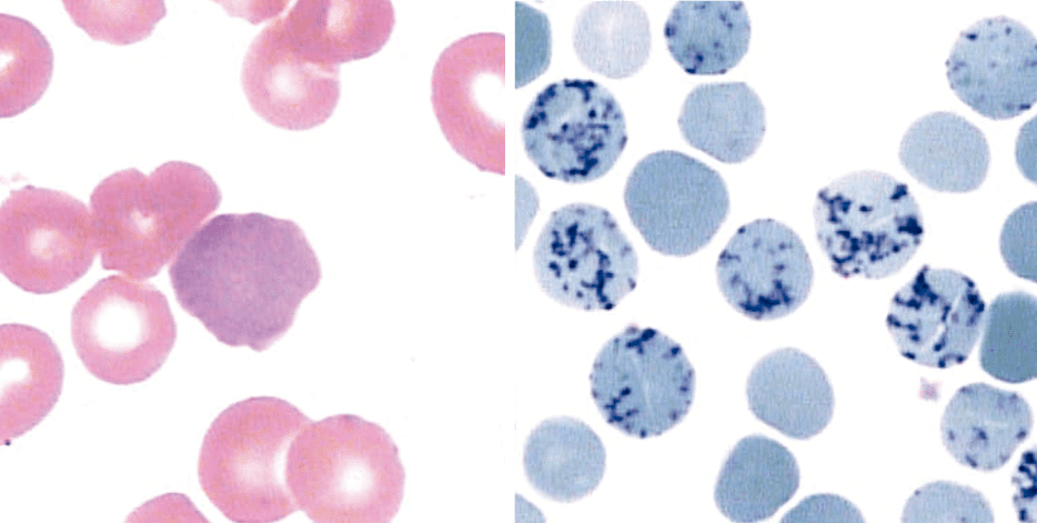 Introdução à Hematologia