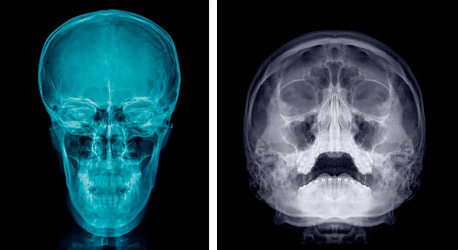 Incidências de crânio e coluna