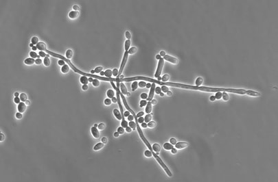 Detecção e identificação dos fungos de importância médica