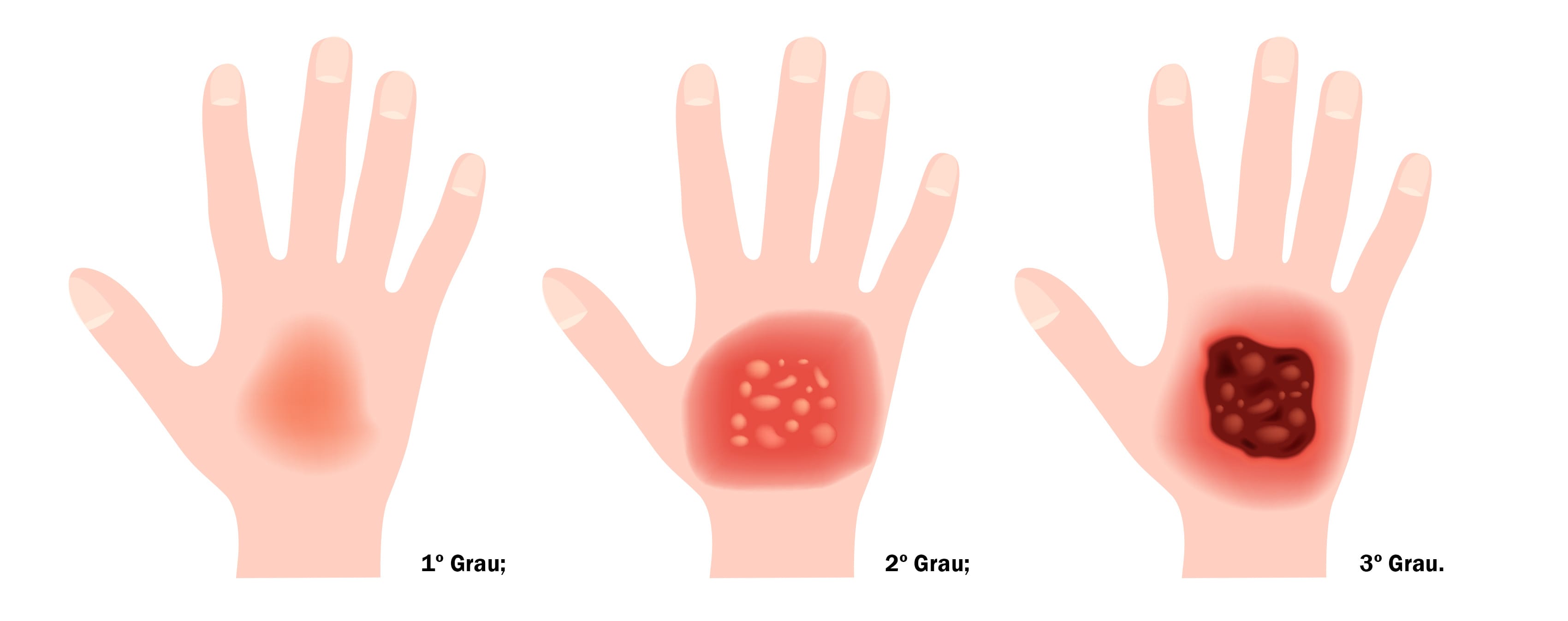 Primeiros Socorros e Segurança em Ambientes de Laboratório