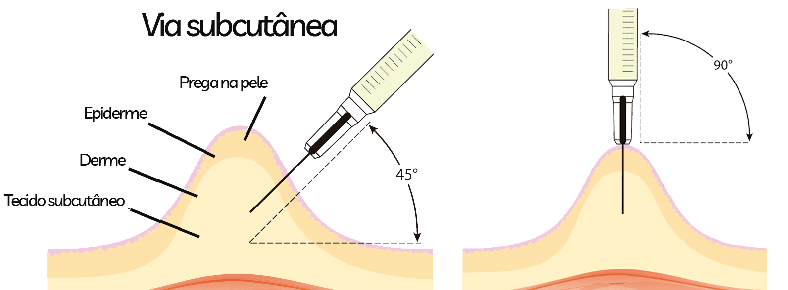 Procedimentos injetáveis