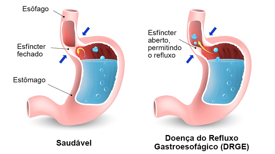 Sistema Digestório e Manifestação Clínica